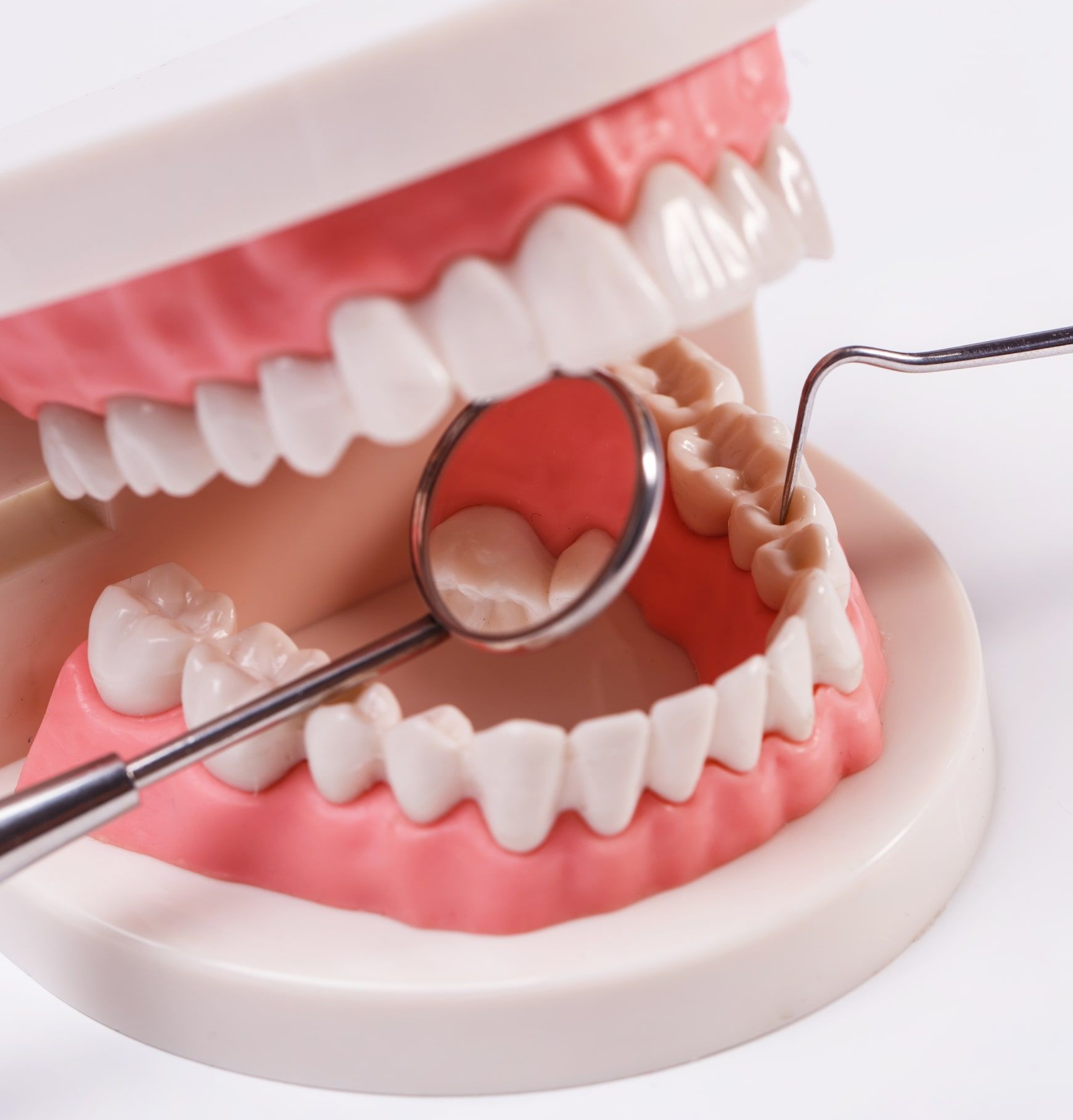 Zobu higiēna | apinesklinika.lv