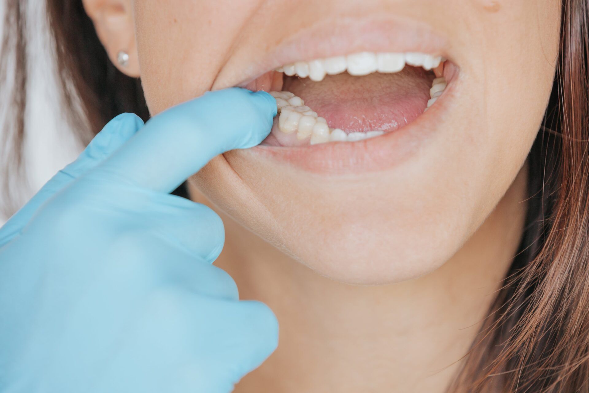 Zobu ekstrakcija | apinesklinika.lv